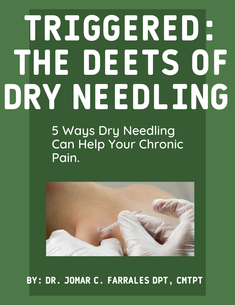 Triggered: The Deets to Dry Needling - 5 Ways Dry Needling Can Help ...